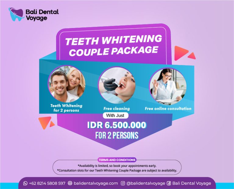 Teeth Whitening Bali - Bali Teeth Whitening Cost
